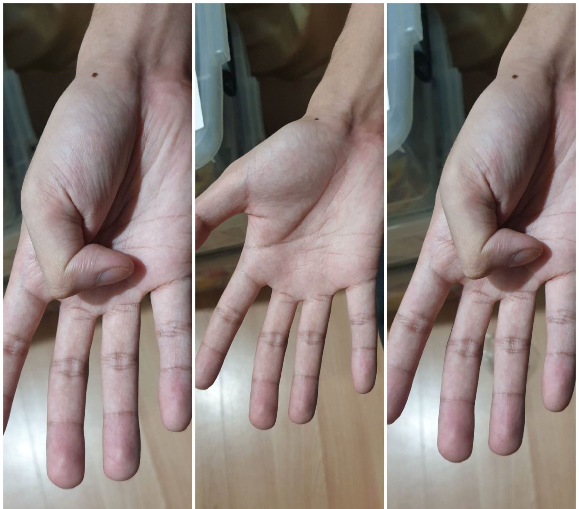 Hand Exercises for Musicians to Relieve Pain and Tension - Jazer Lee Piano