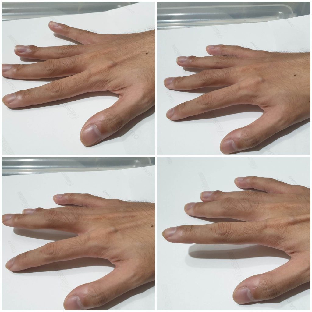 Hand Exercises for Musicians to Relieve Pain and Tension - Jazer Lee Piano