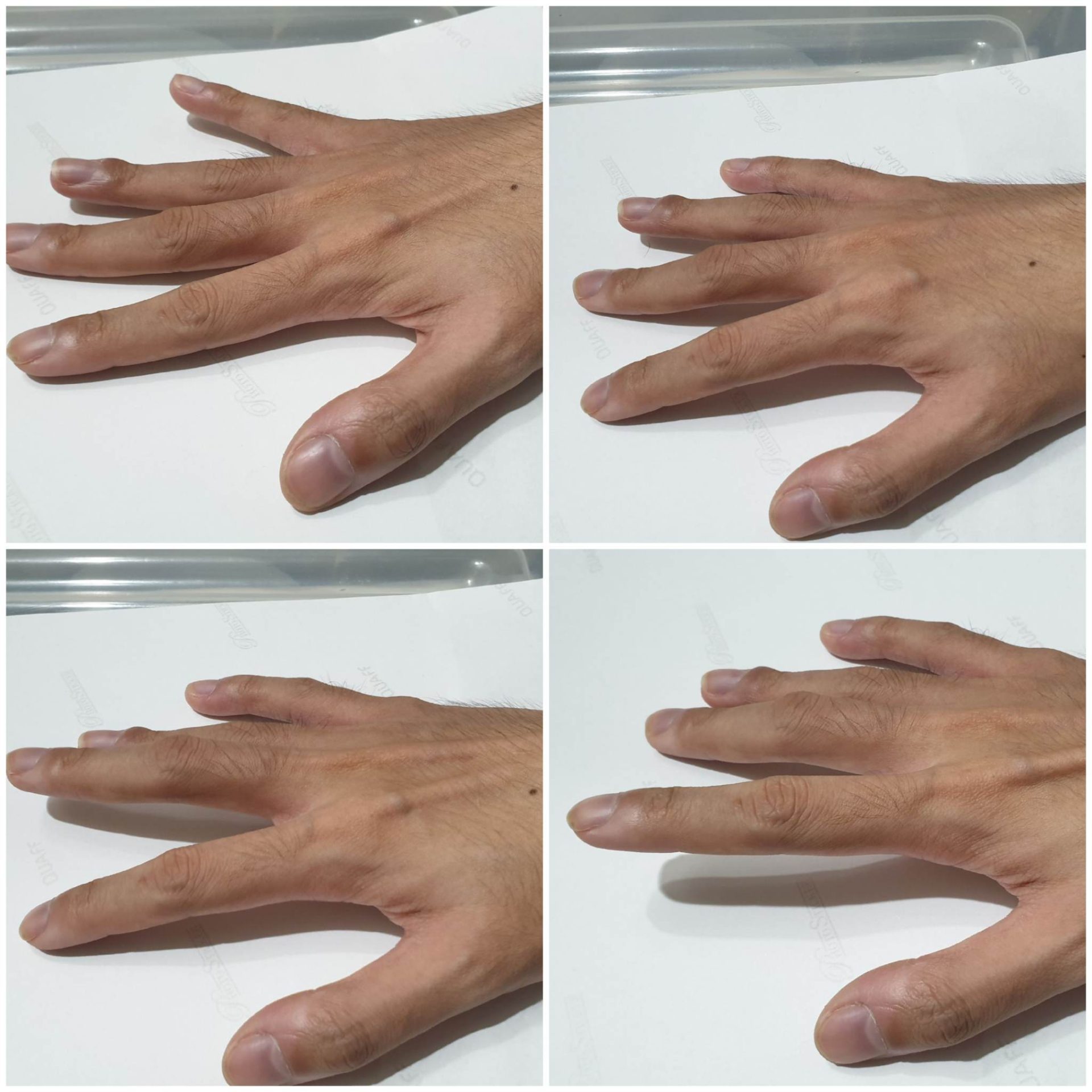 Hand Exercises for Musicians to Relieve Pain and Tension - Jazer Lee Piano